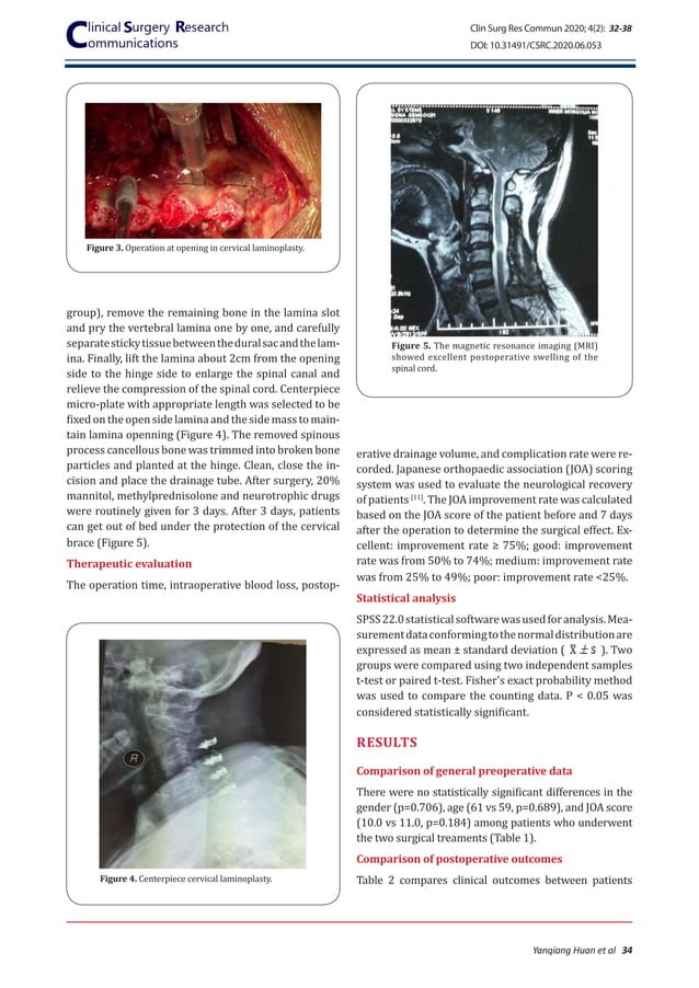 Application Of Piezosurgery Osteotomy In Cervical Laminoplasty