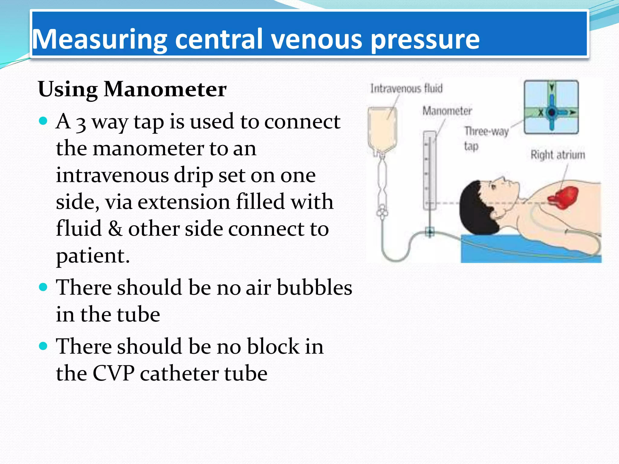 Application of pressure in nursing ( biophysics) | PPTX