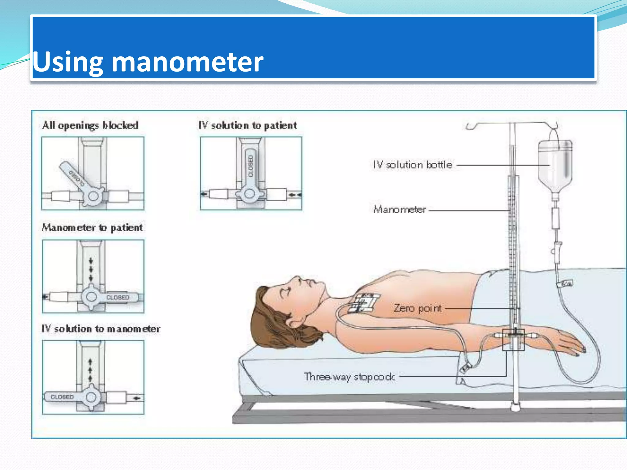 Application of pressure in nursing ( biophysics) | PPTX