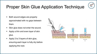 Application of Skin Glue in Circumcision.pdf