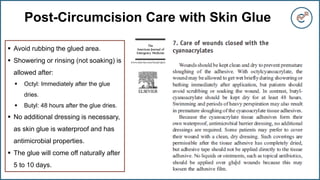 Application of Skin Glue in Circumcision.pdf