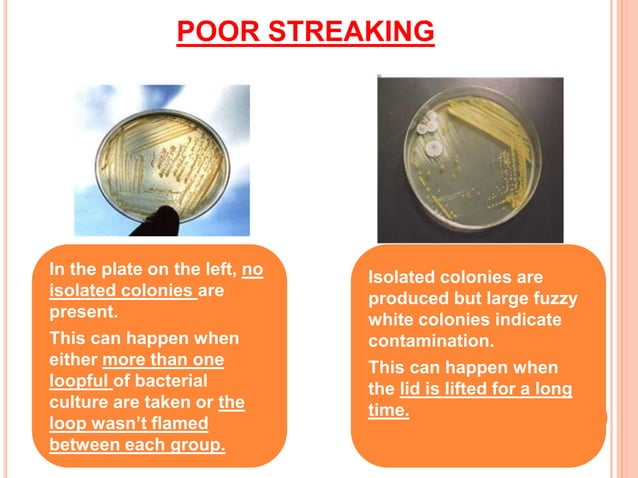 Application of streaking | PPTX | Infectious Diseases | Diseases and ...