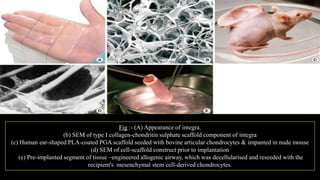 Application of Tissue engineering in Cartilage, Cardiac, Pancreas ...