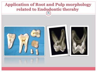 Application of tooth anatomy in denta practice | PPTX