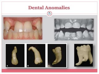 Application of tooth anatomy in denta practice | PPTX