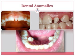 Application of tooth anatomy in denta practice | PPTX