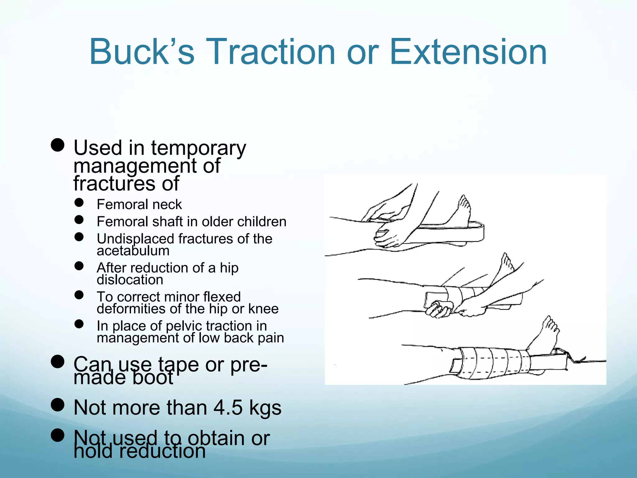 Application of traction in orthopaedics | PPT