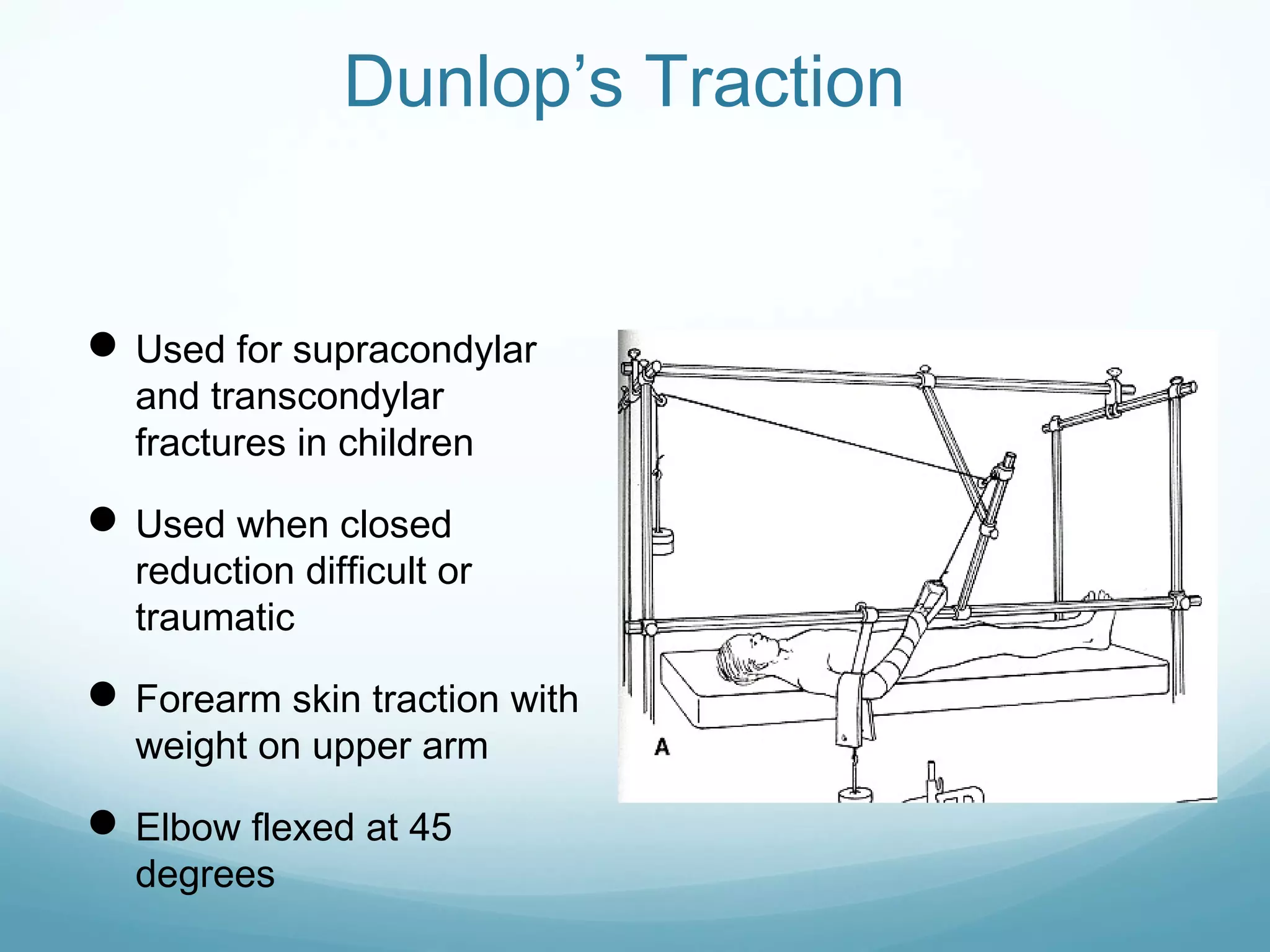 Application of traction in orthopaedics | PPT