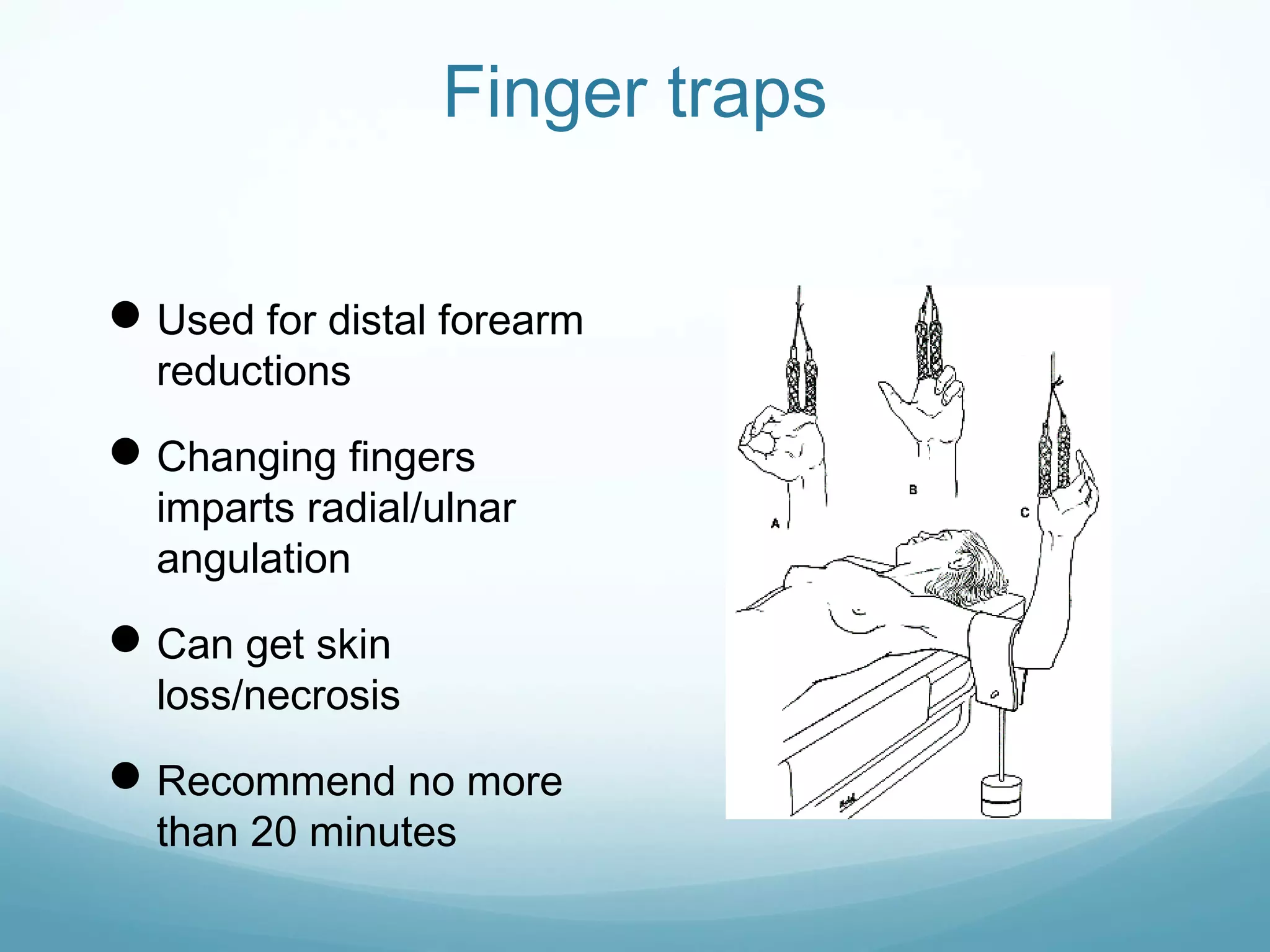 Application of traction in orthopaedics | PPT