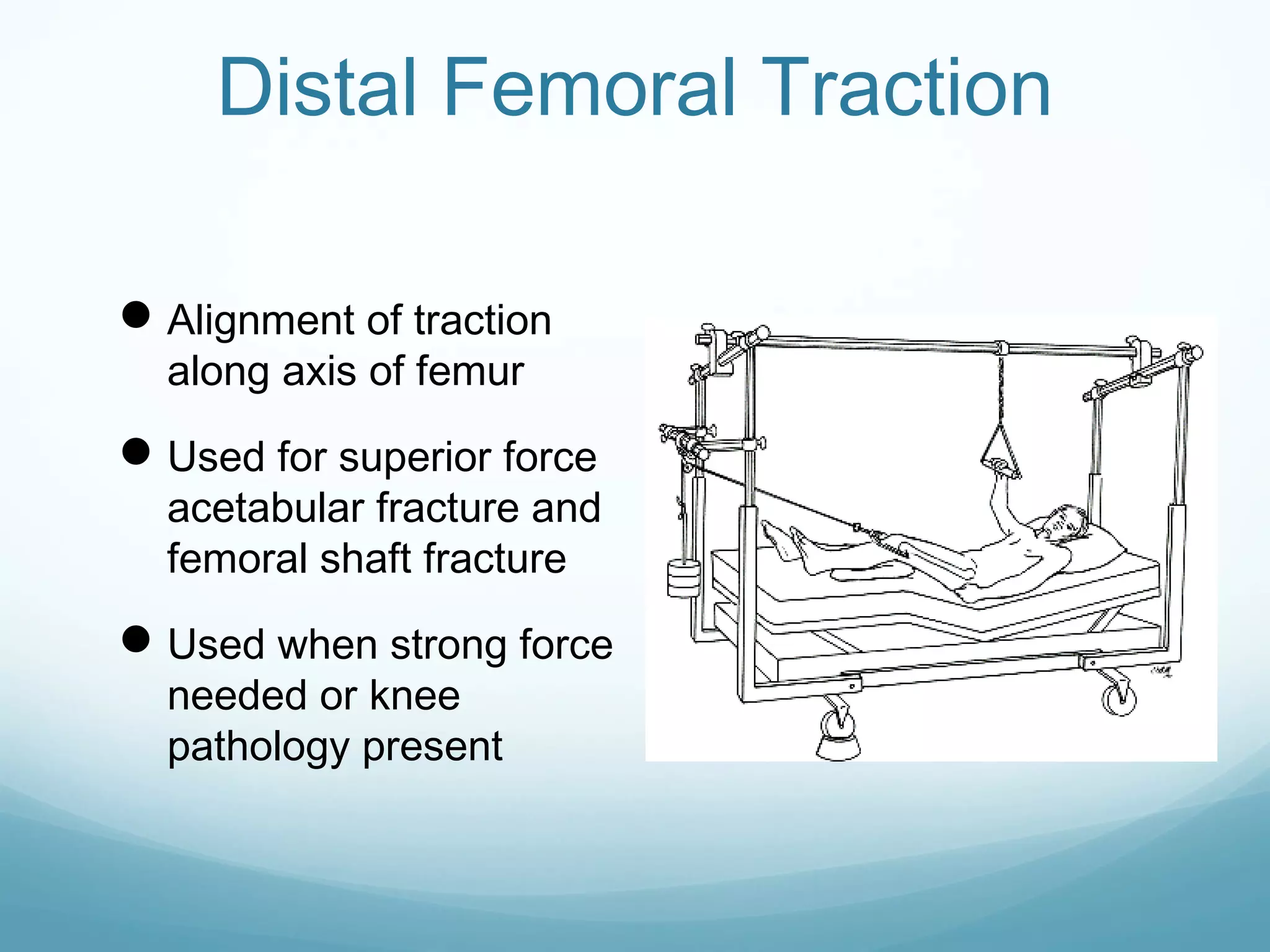 Application of traction in orthopaedics | PPT