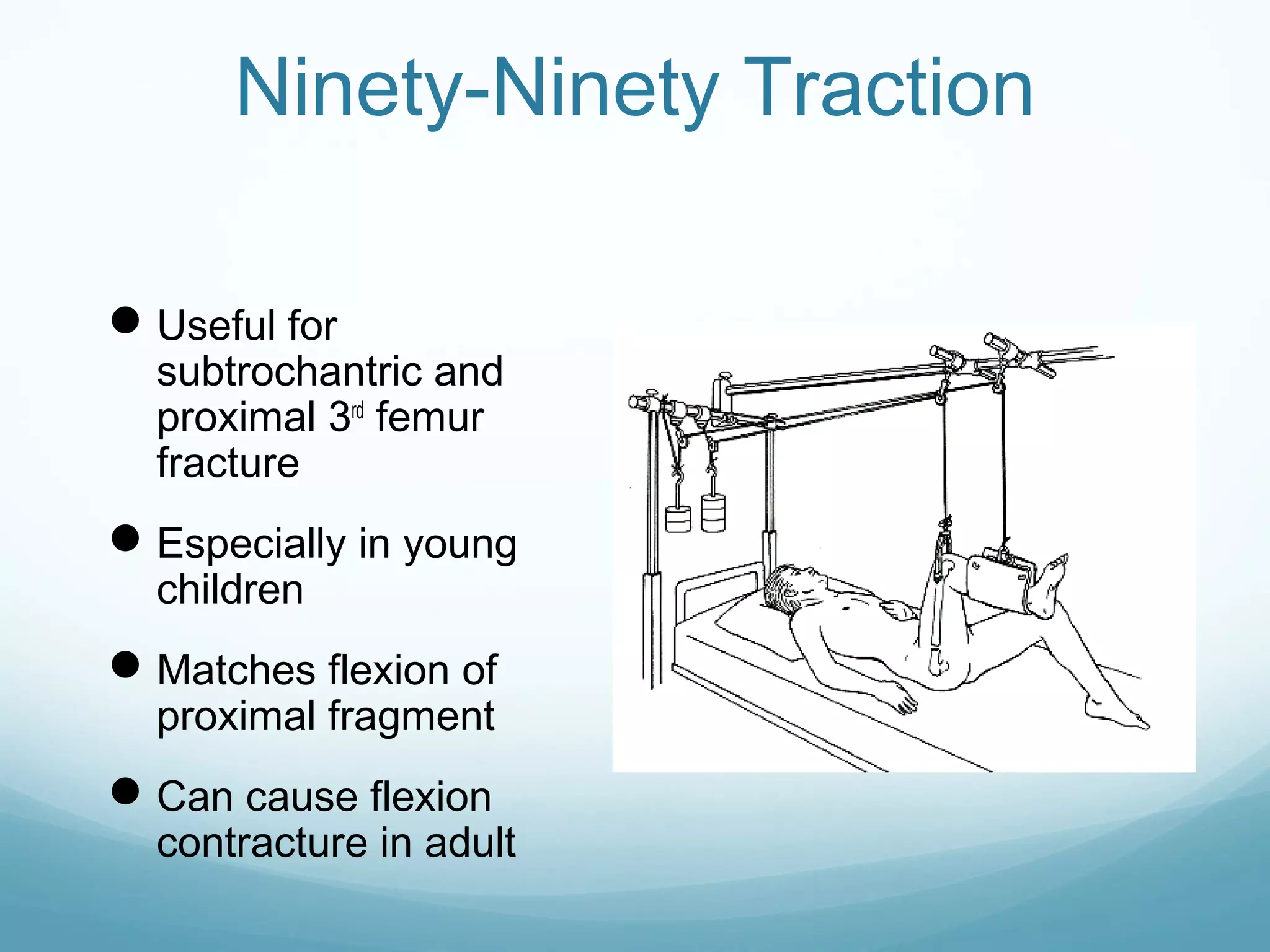 Application of traction in orthopaedics | PPT