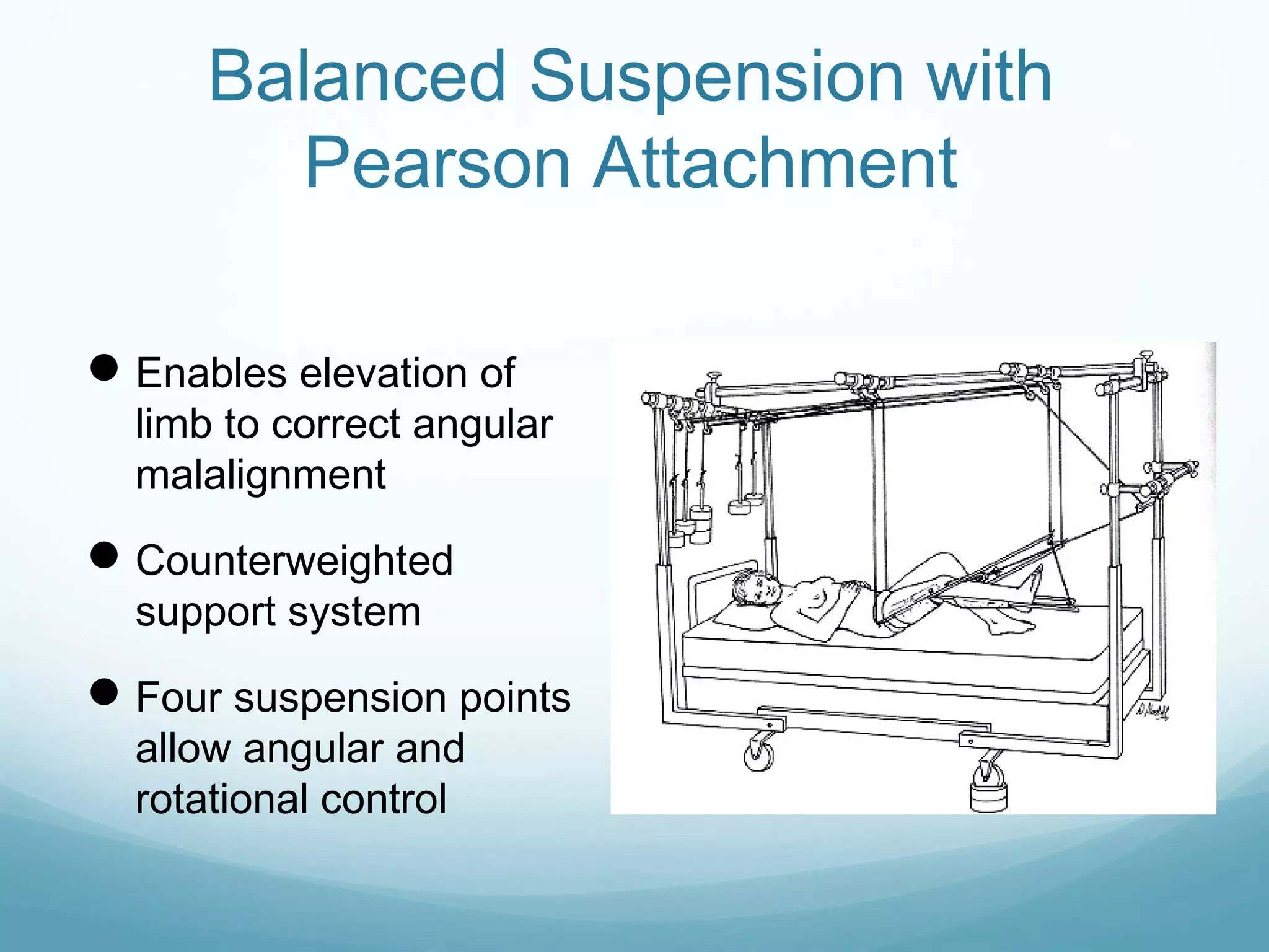 Application of traction in orthopaedics | PPT