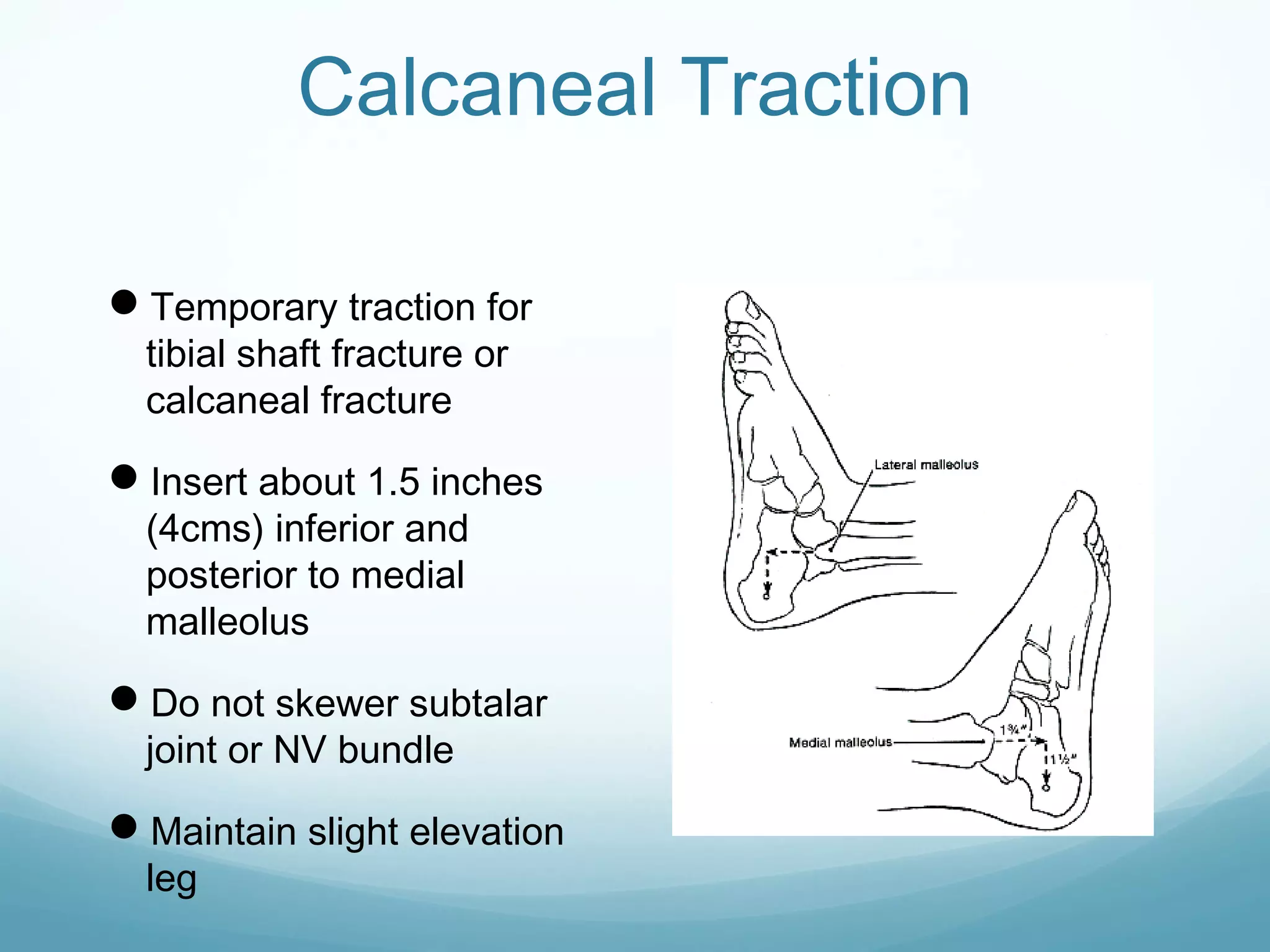 Application of traction in orthopaedics | PPT
