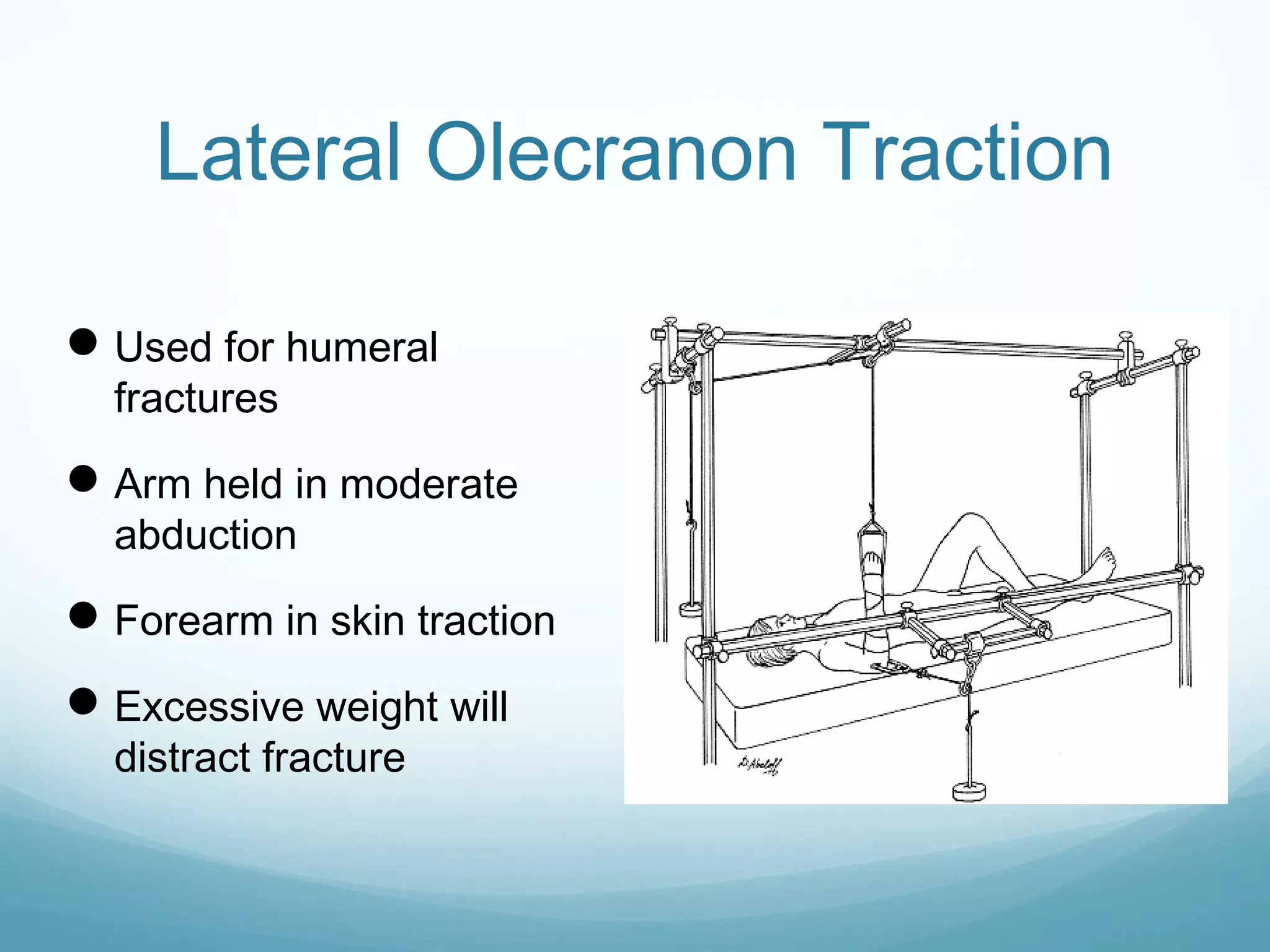 Application of traction in orthopaedics | PPT