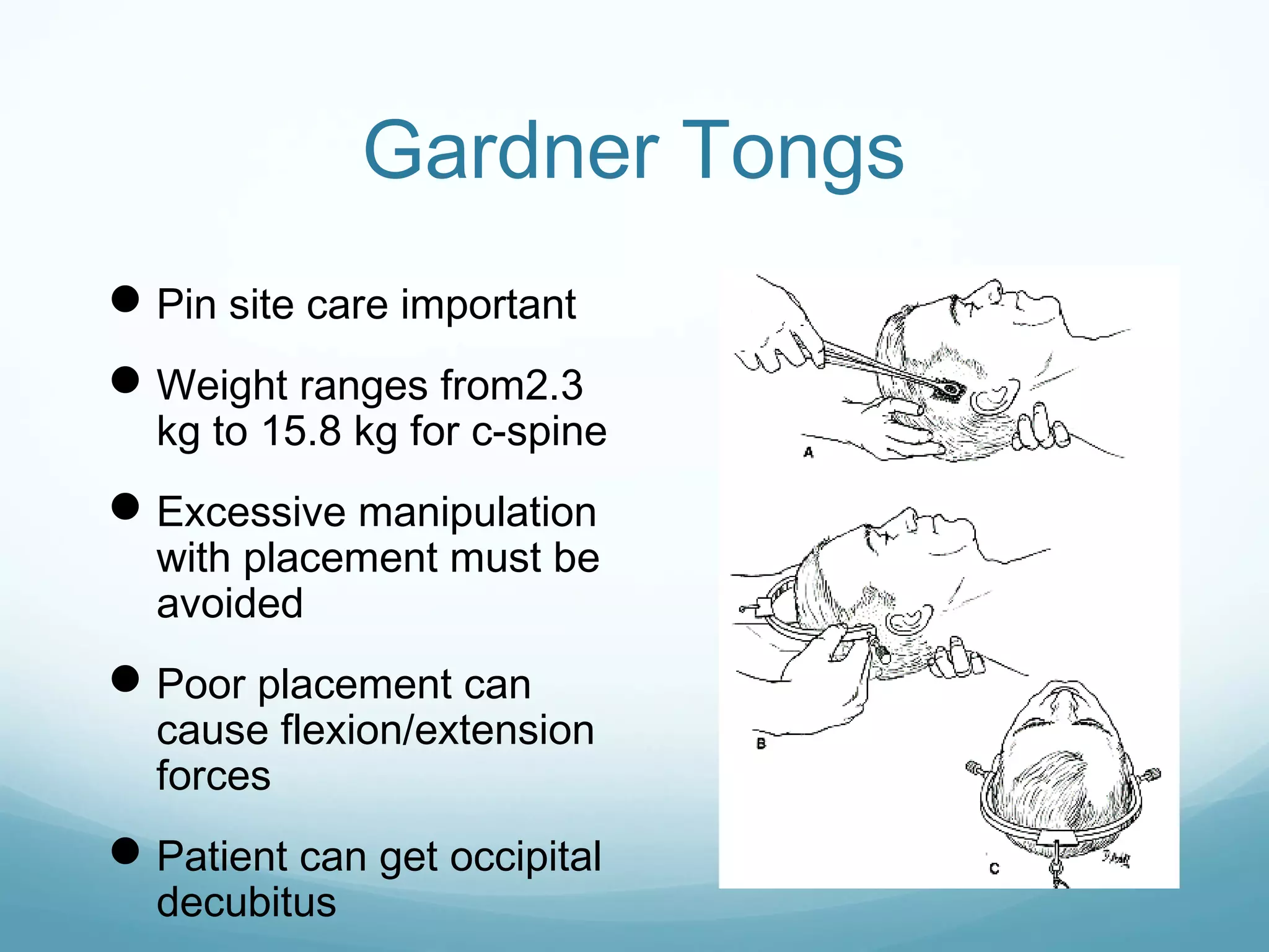 Application of traction in orthopaedics | PPT