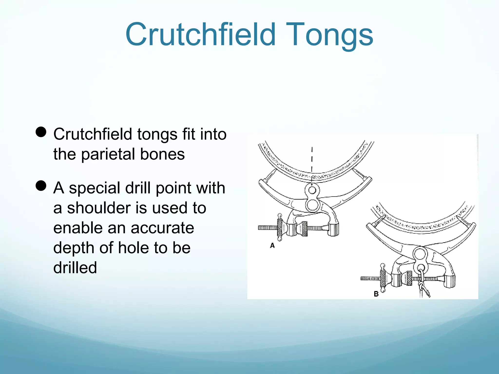 Application of traction in orthopaedics | PPT