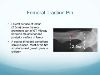 Application of traction in orthopaedics | PPT
