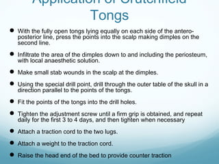 Application of traction in orthopaedics | PPT