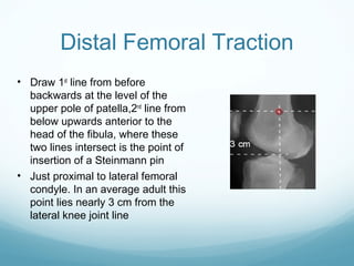 Skeletal Traction Pin Site Care