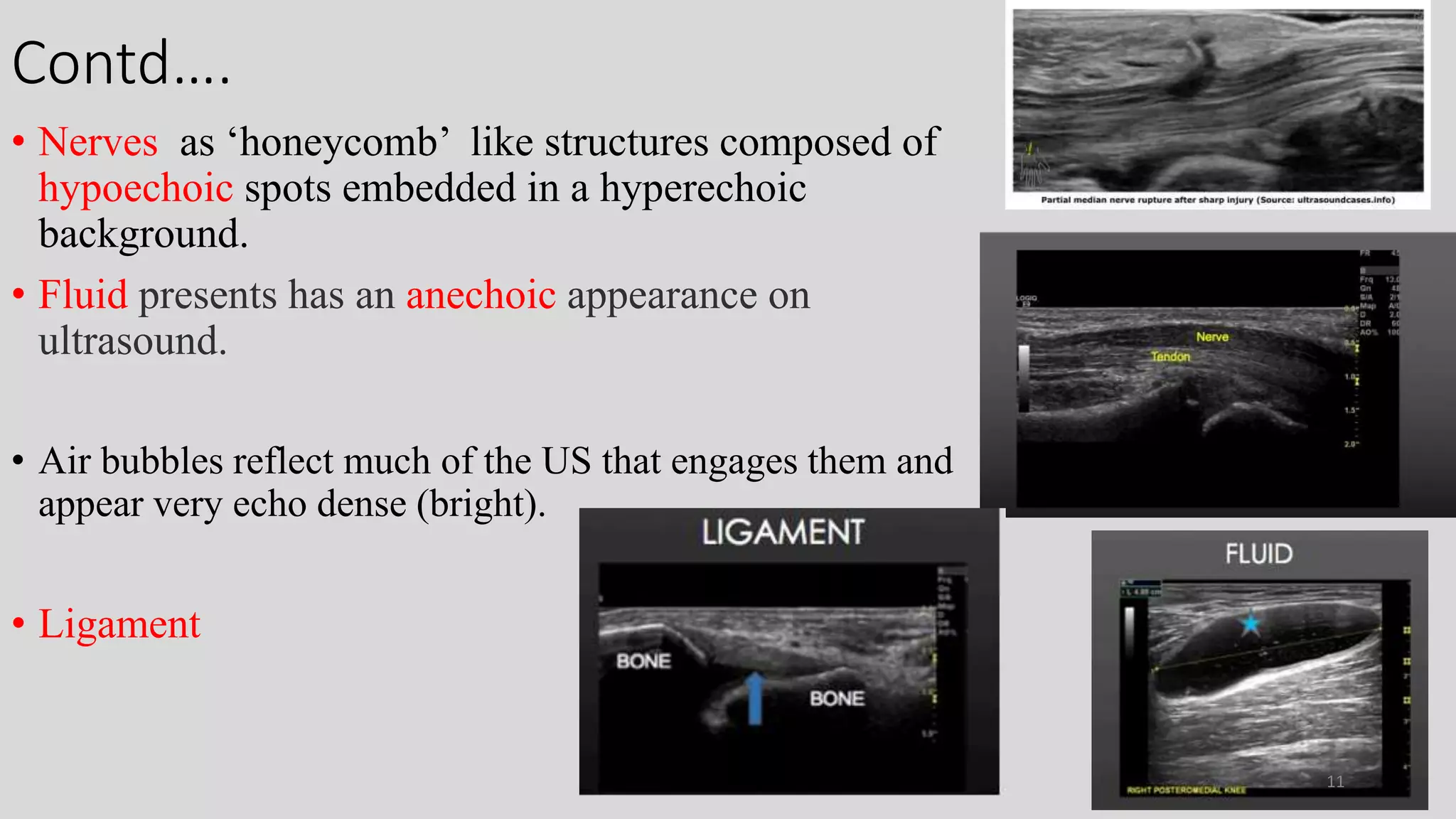Application of ultrasound | PPTX
