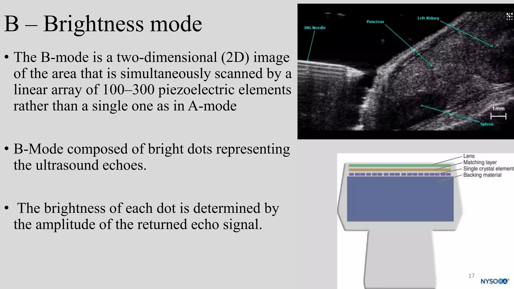 Application of ultrasound | PPTX