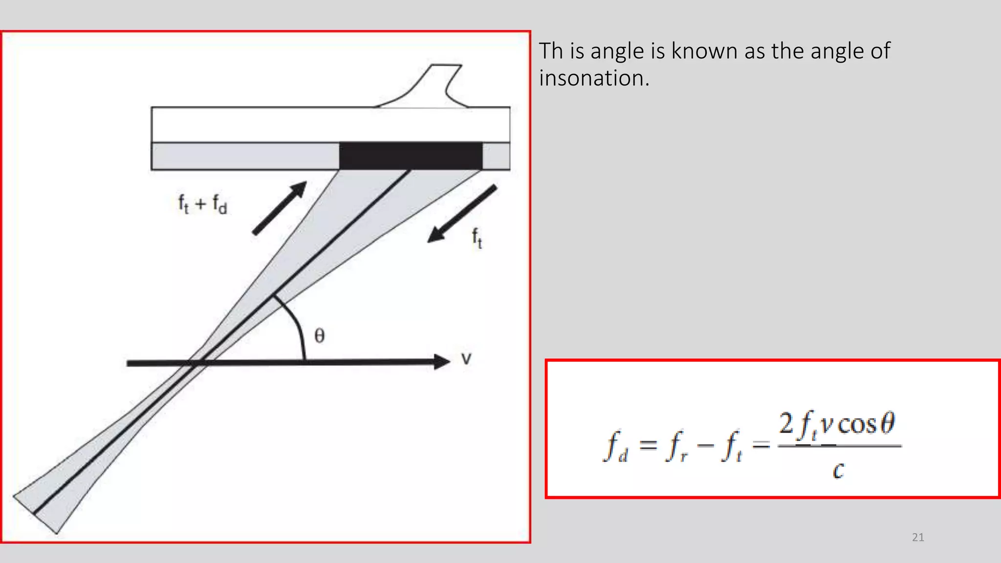 Application of ultrasound | PPTX