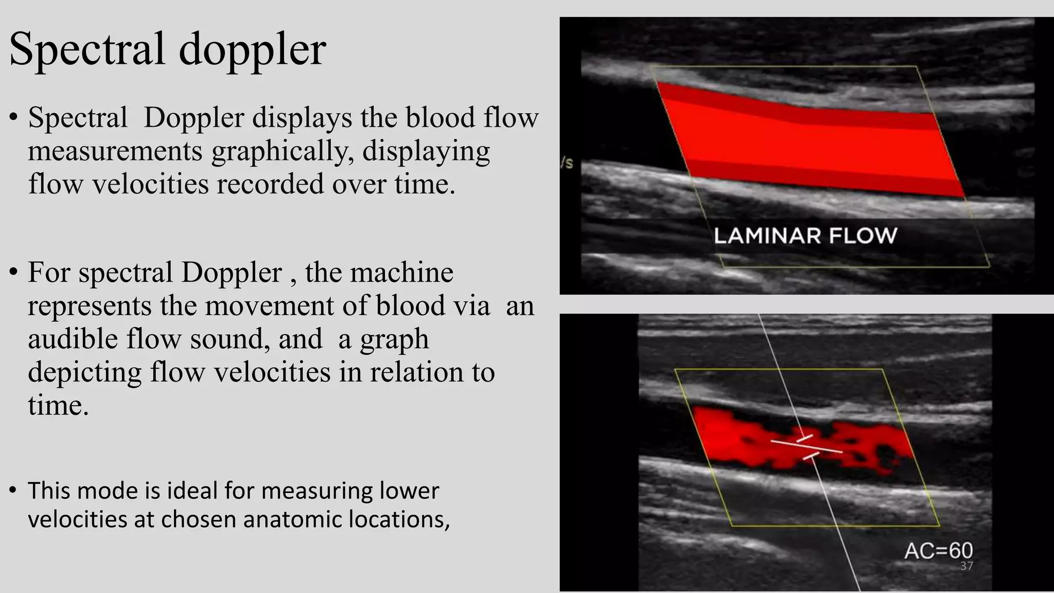 Application of ultrasound | PPTX
