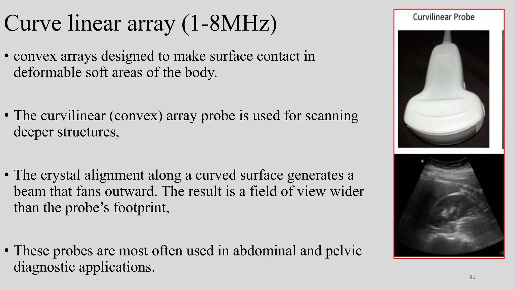 Application of ultrasound | PPTX
