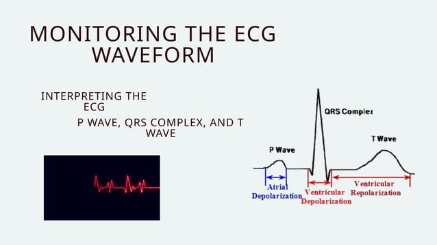Application of YSECG - V3V and how an ecg equipment work | PPT