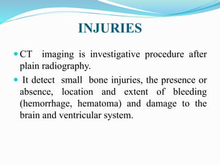 Applications of computer tomography | PPTX