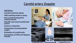Applications of Doppler(Carotid/Splenoportal/Renal and AV Fistula).pptx