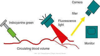 Applications of Indocyanine Green in Surgery.pdf