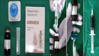 Applications of Indocyanine Green in Surgery.pdf