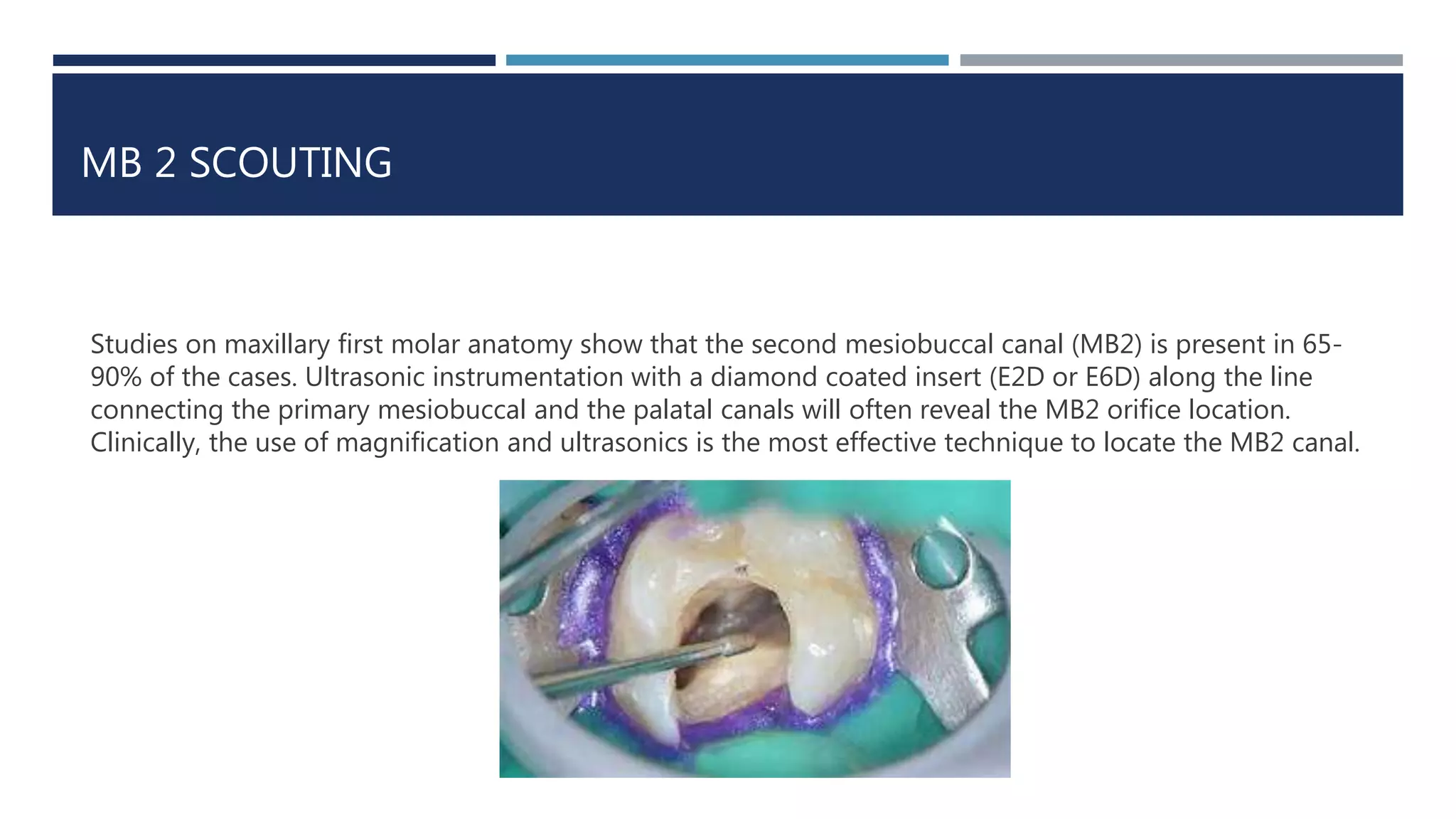 Applications of ultrasonics in endodontics | PPTX