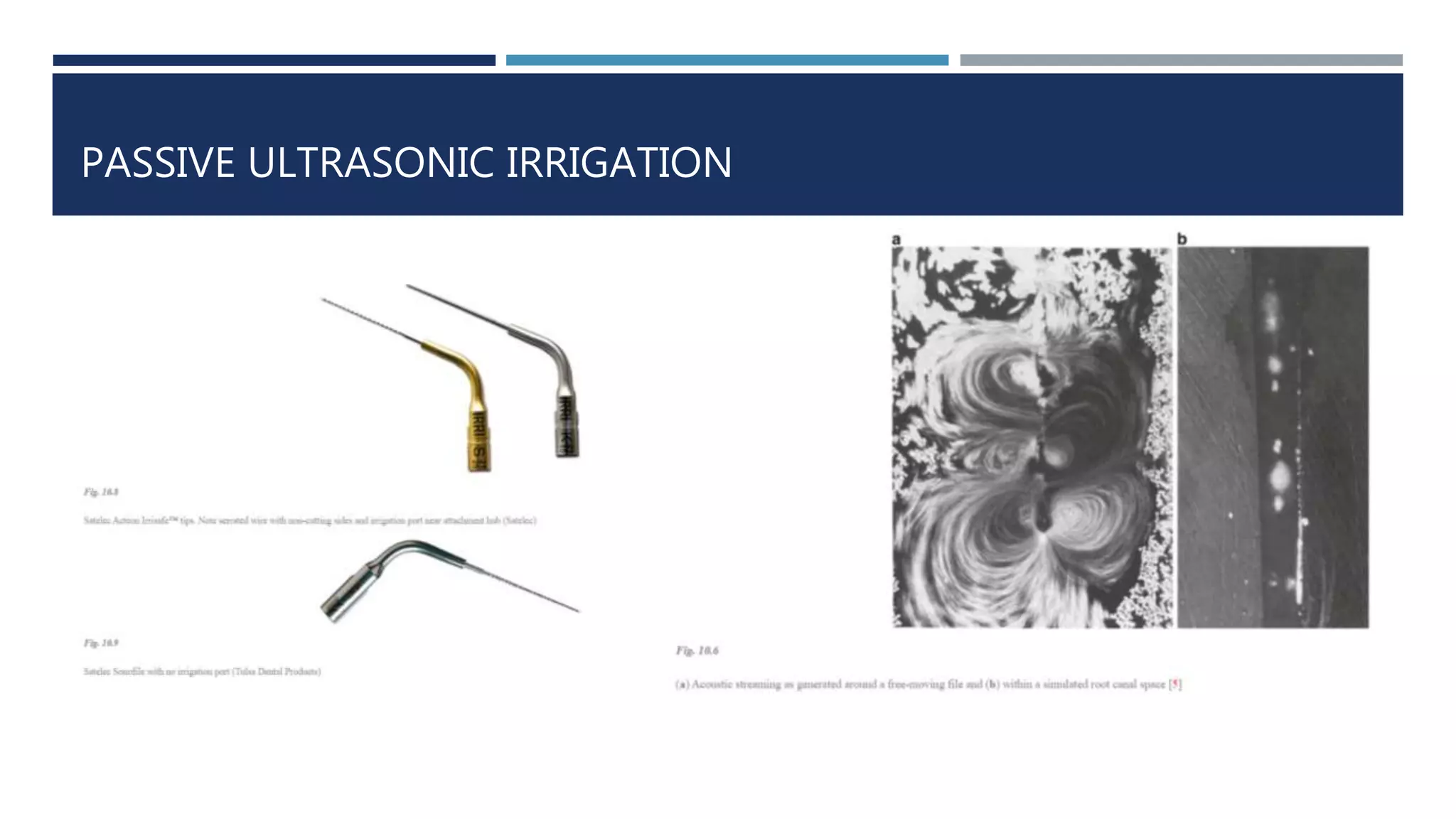 Applications of ultrasonics in endodontics | PPTX