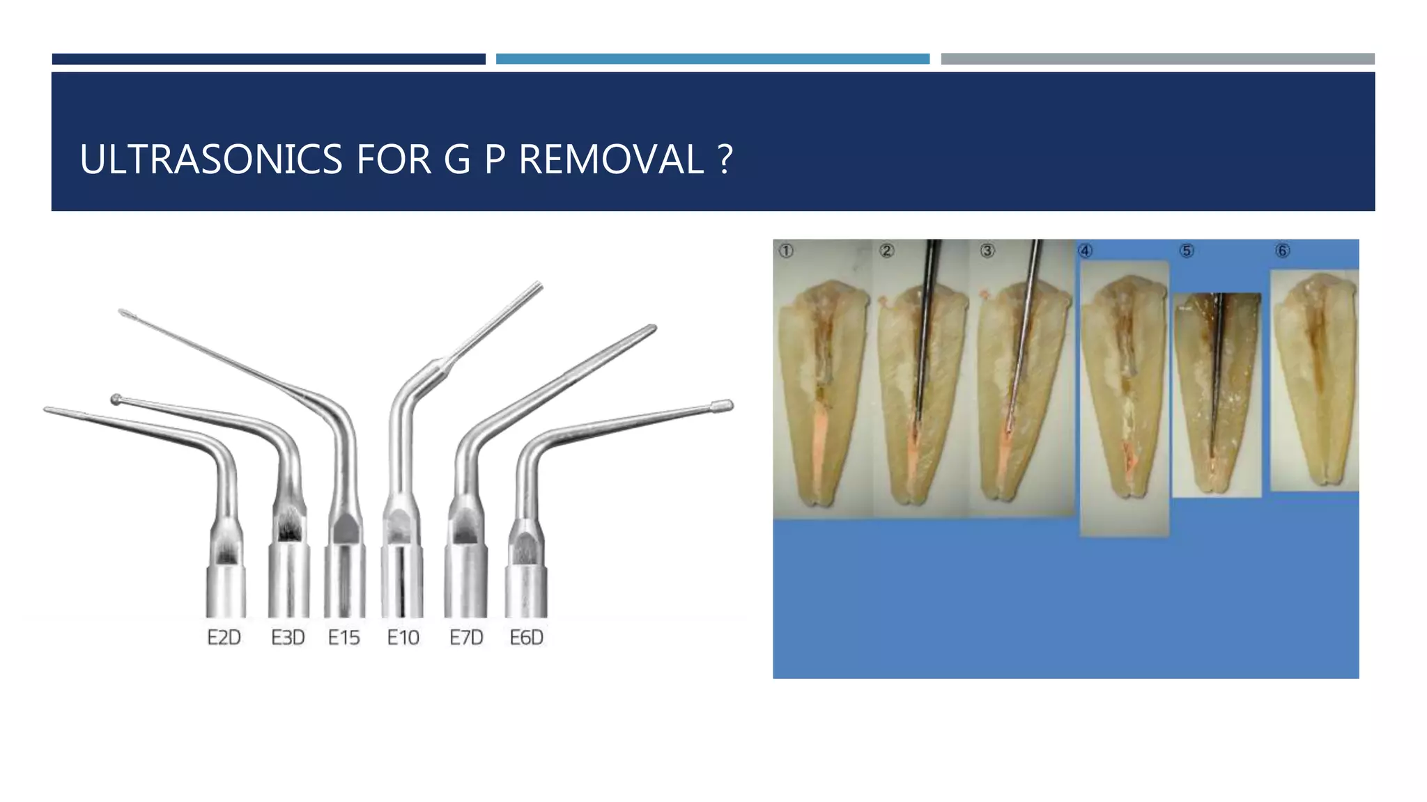 Applications of ultrasonics in endodontics | PPTX