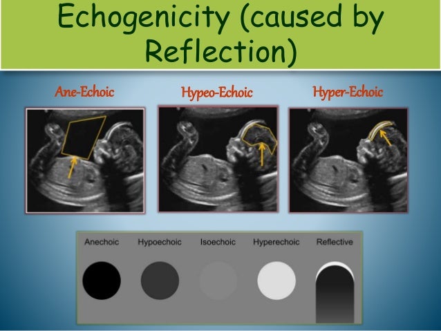 Applications of Ultrasound in Medicine