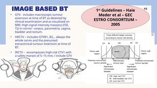 Applicators for Brachytherapy in Ca cervix.pptx