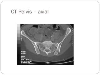 Applied anatomy.ppt ct, mri y3s2 3220 | PPT