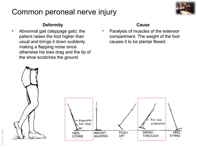 Applied anatomy common peroneal nerve injury | PPT