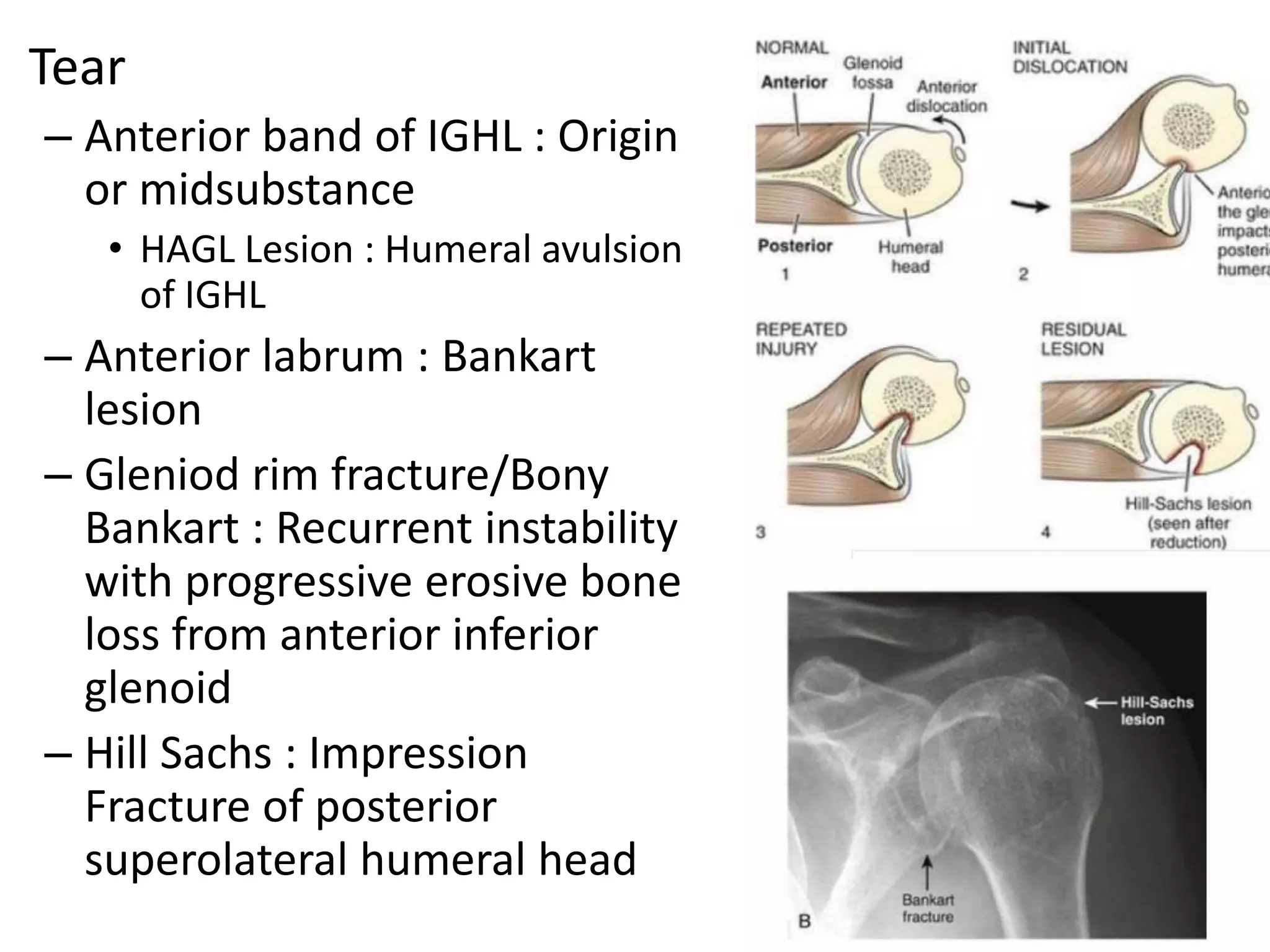 Applied anatomy Of Upper Limb | PPTX