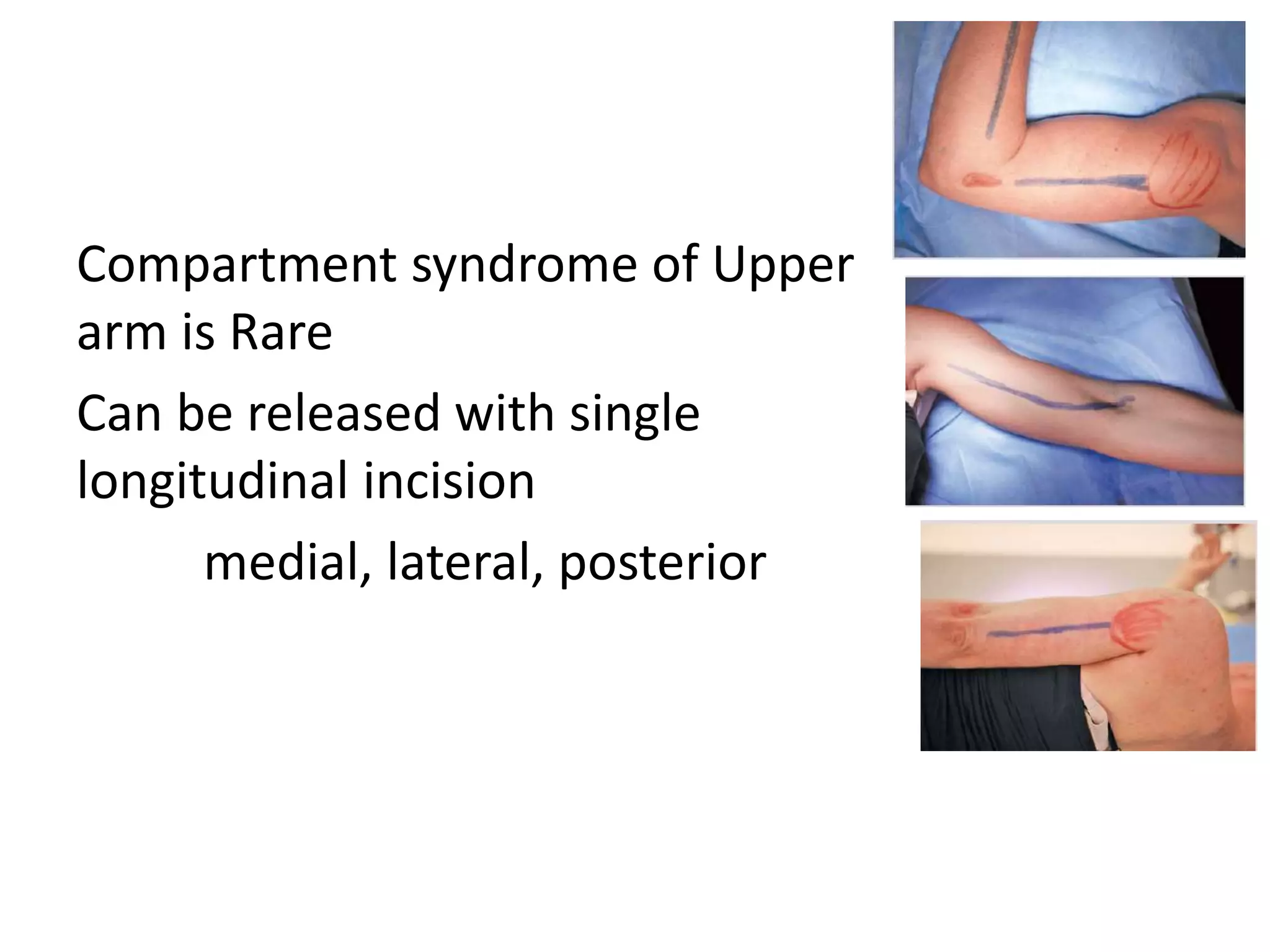 Applied anatomy Of Upper Limb | PPTX