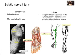 Applied anatomy sciatic nerve injury | PPT