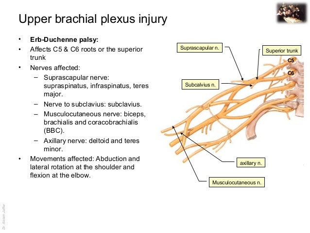 Applied anatomy upper brachial pleuxs injury