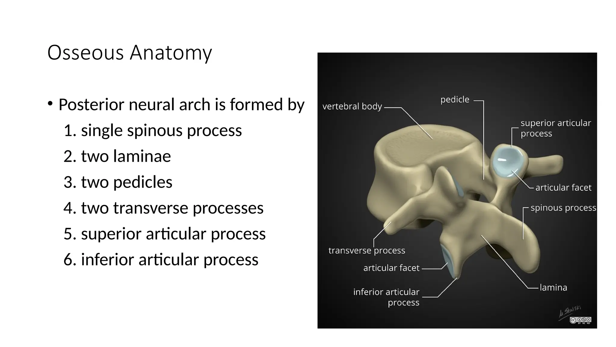 Applied Anatomy and Percutaneous Approaches to the Lumbar spine | PPTX