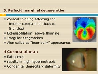 Applied anatomy and physiology of cornea | PPTX