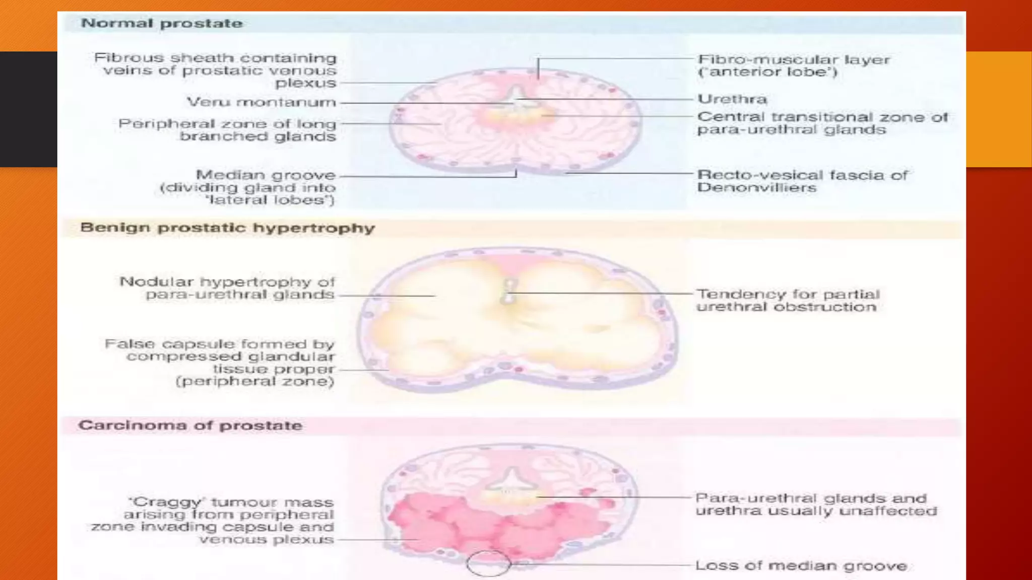 Applied anatomy, GU system.pptx