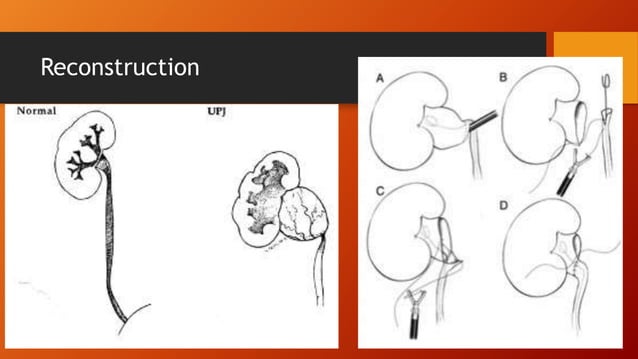 Applied anatomy, GU system.pptx | Reproductive Health | Diseases and ...