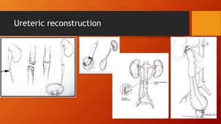 Applied anatomy, GU system.pptx