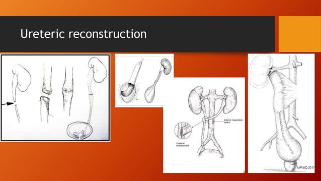 Applied anatomy, GU system.pptx | Reproductive Health | Diseases and ...